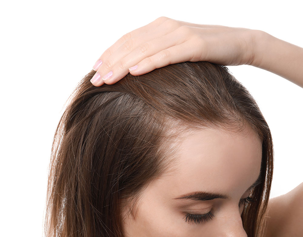 Haarverlust bei Teenager • Haarausfall Hilfe