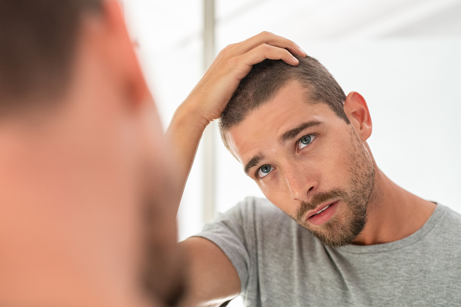 Haarausfall mit Anfang 20 • Haarausfall Hilfe