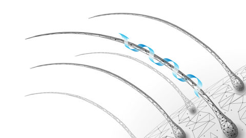 NEO FUE Haartransplantation • Haarausfall Hilfe